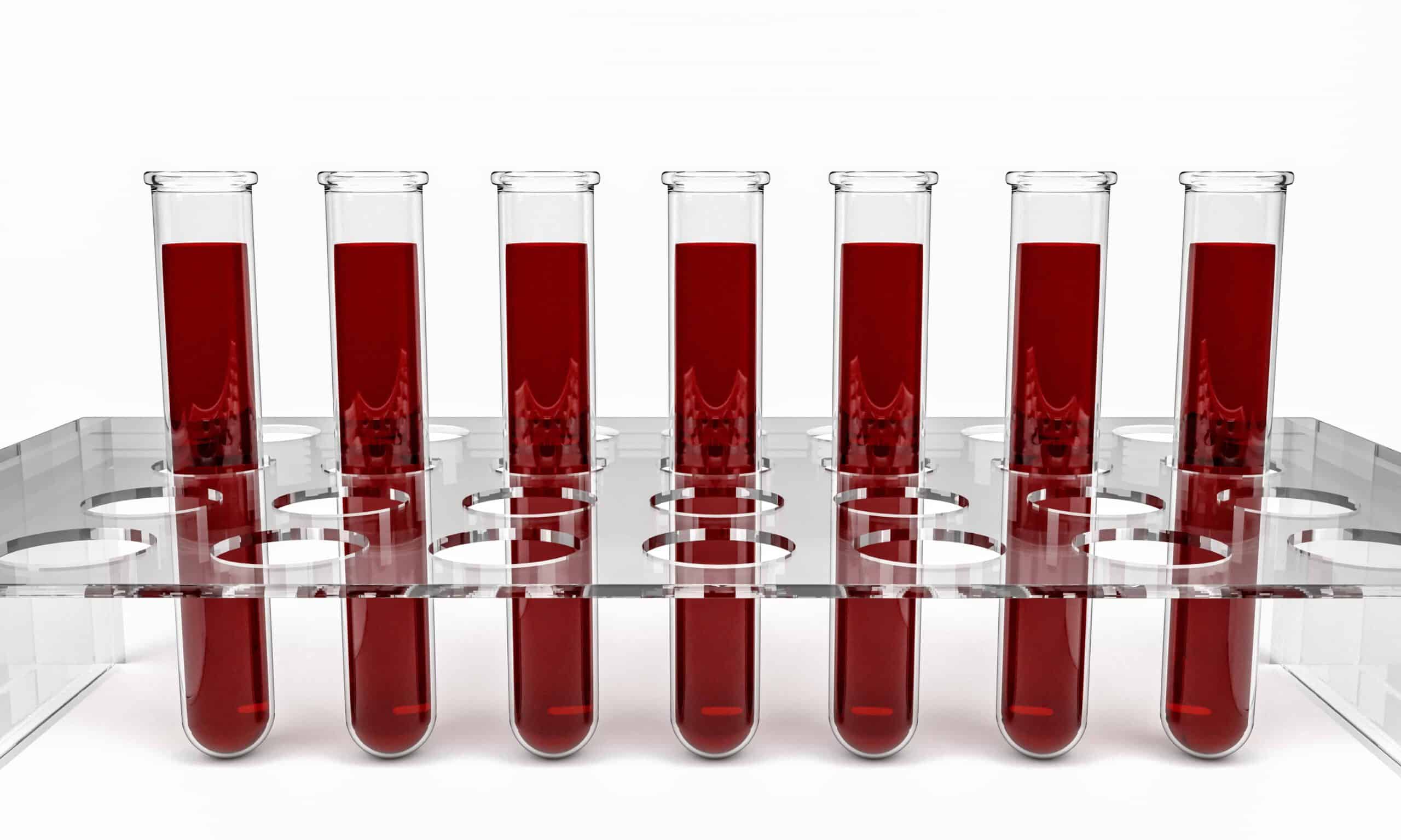 Co to są eozynofile? O czym świadczy zbyt niski i podwyższony poziom ...