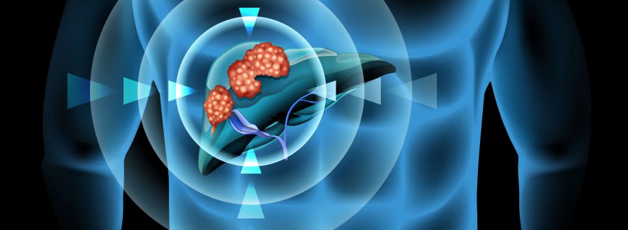 Czym jest naczyniak wątroby, jego objawy, przyczyny i sposoby leczenia ...